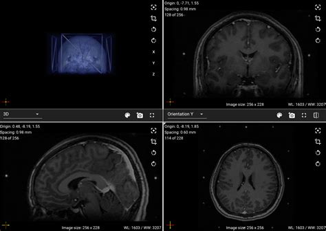 Read Dicom With Jpeg Compress Data · Issue 145
