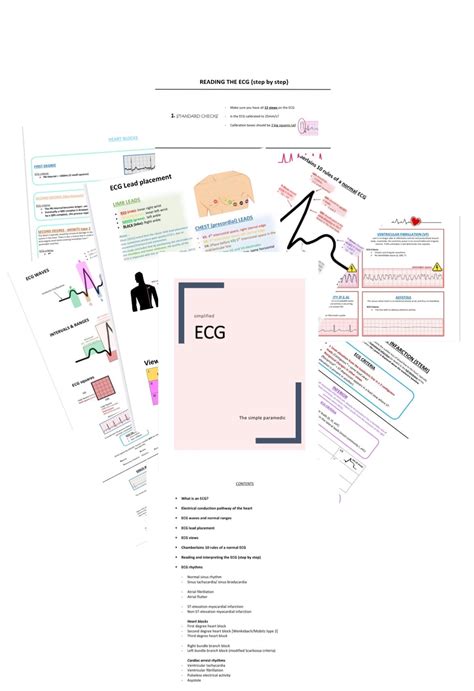 Ecg Notes Printable Etsy