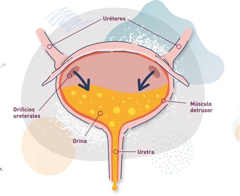 Guía Para Pacientes De Cáncer De Vejiga Detección Y Tratamiento