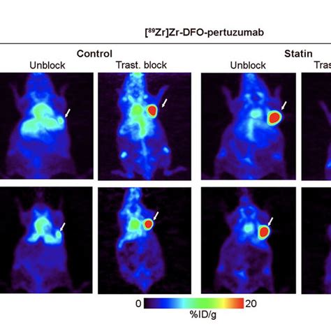 Trastuzumab Receptor Blockade Increases Internalization Of 89