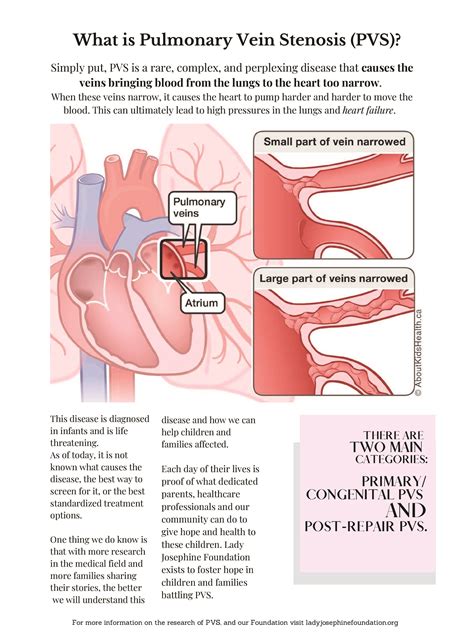 PVS Resources Lady Josephine Foundation