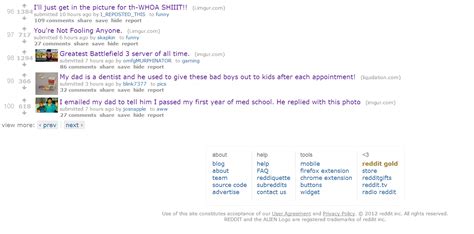 i think there are new next and prev buttons mildlyinteresting