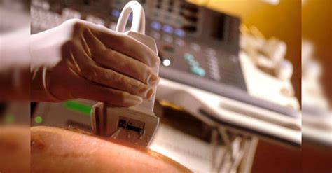 Female Foeticide Make Sex Determination Test Compulsory Says Female Foeticide Make Sex Determination Test Compulsory Says