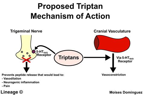 Sumatriptan Neurology Medbullets Step 1