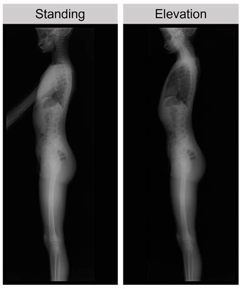 Lower Back Alignment