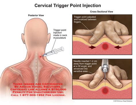 Medical Exhibits Demonstrative Aids Illustrations And Models
