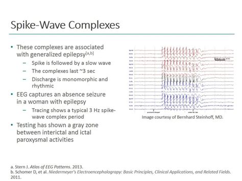 Improving Diagnostic Accuracy In Epilepsy Ppt Download