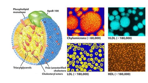 There Is A Positive Causal Relationship Between The Size Of Hdl