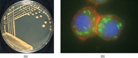 Rhodococcus Equi Veterian Key