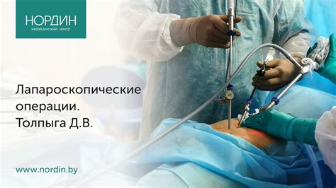 Лапароскопические операции особенности выполнения как восстановиться после операции Youtube