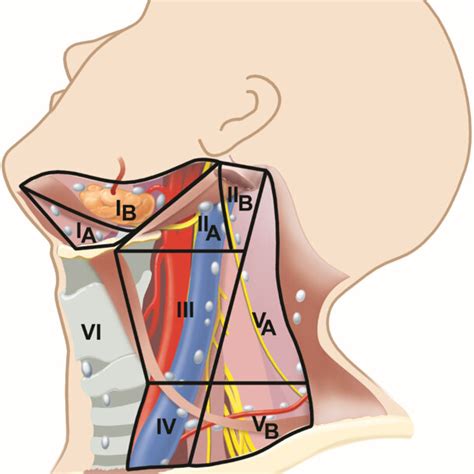 Patterns Of Metastatic Spread To Lateral Neck Lymph Nodes From Download Scientific Diagram