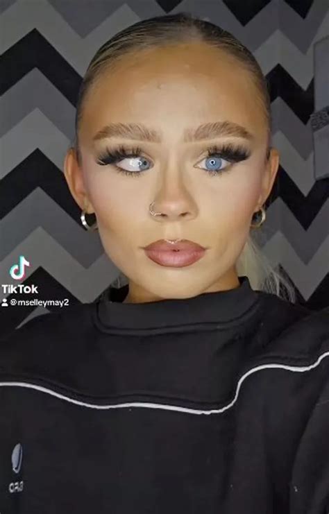 Model Trolled For Lazy Eye Transforms After Undergoing Corrective Surgery Daily Star