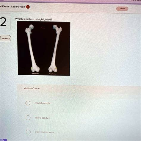 Solved Exam Lab Portion 1 Which Structure Is Highlighted Multiple Choice Medial Condyle