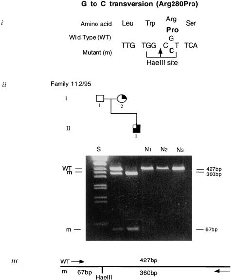 Detection Of Mutation In Exon In Family By Restriction Enzyme Download Scientific
