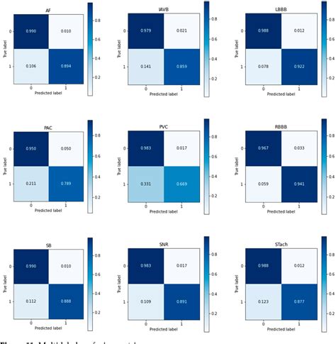 Figure 11 From Automatic Classification Method Of Arrhythmias Based On