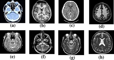 Embedded Images Tested With A Text Size Of 128 Bytes Download