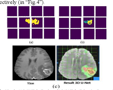 Figure 1 From Brain Mri 3d Segmentation Using Patch Spatially Localized Network Tiles Utilizing