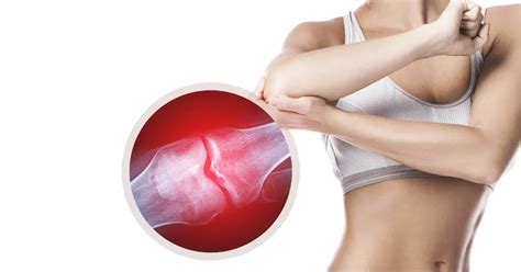 Elbow Fractures Life Physiotherapy Clinic