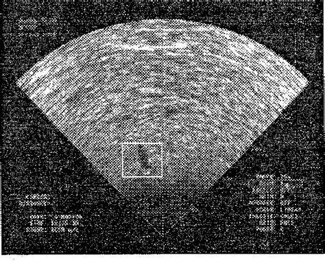 Figure 1 From Three Dimensional Reconstruction Of Underwater Objects