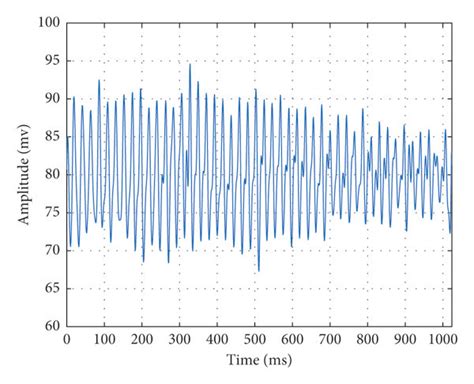 Results Of Vibration Signal Processing A Waveforms Of The Original