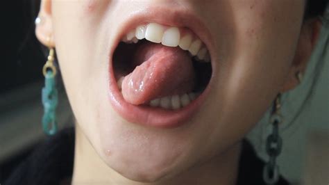 Aurora Treasures Auroras Teeth Bite To Your Delight