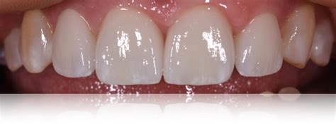 Responsive Breakpoints Feature Creates Brighter Images Cloudinary Support