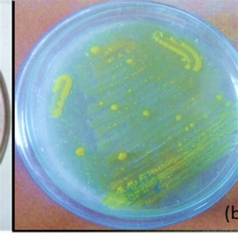 Cultural Microscopic And Biochemical Characteristics Of Staphylococcus