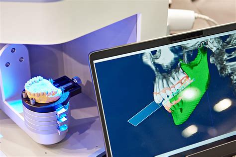 ¿qué Es La Odontología Digital Y Cómo Beneficia A Los Pacientes