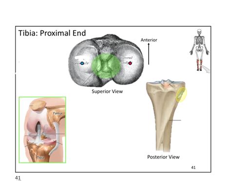 Tibia Proximal End Quiz