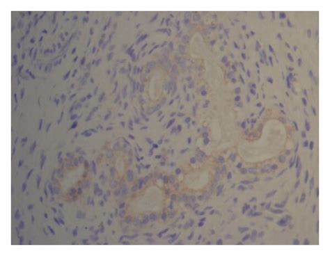 The Expression Of Pr In Eutopic Endometrium Dab Stain ×400 A
