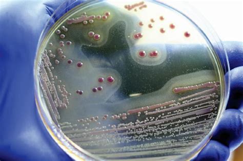 The Rise Of Small Molecule Enzyme Substrates In Microbiology Manufacturing Chemist