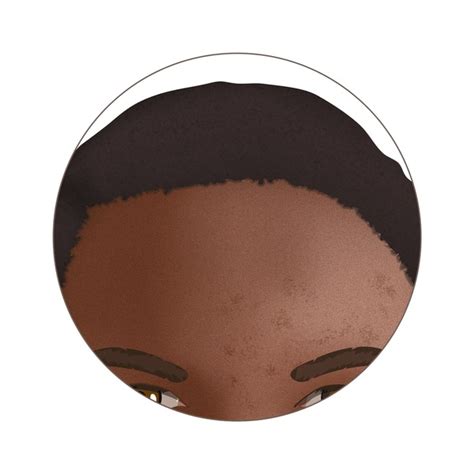 Arm Hyperpigmentation Over 3 Royalty Free Licensable Stock