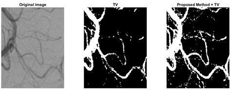 Another Example To Show The Effect Of The Proposed Regularization On Download Scientific