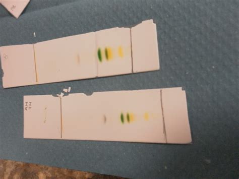 Experiment Extraction Of Chlorophyll And Thin Layer Chromatography My Xxx Hot Girl