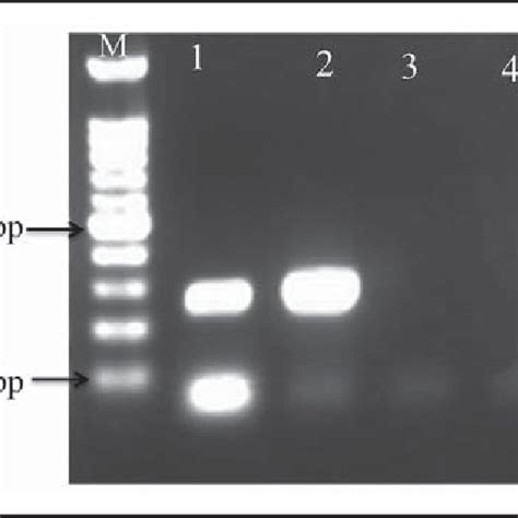 Beta Actin Was Used As Positive Internal Controls For Samples To Verify Download Scientific