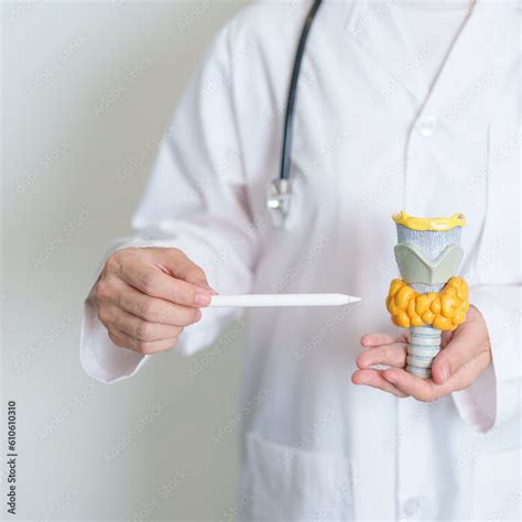 Doctor With Human Thyroid Anatomy Model Hyperthyroidism