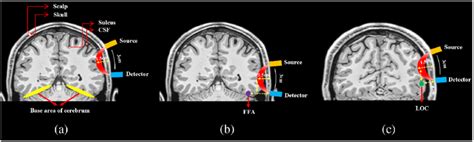 Illustration Of The Fnirs Detection Range For Cortical Regions A The