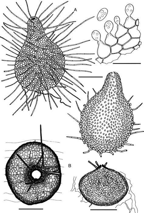 A Setose Pycnidia Top Left And Conidiogenous Cells And Conidia Top Download Scientific