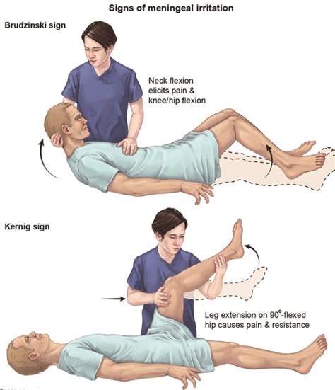 Treatment