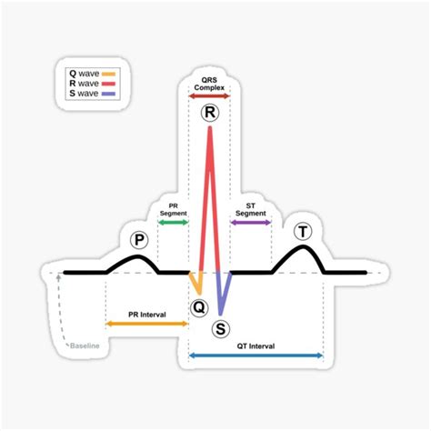 Ekg Sinus Waveform Sticker For Sale By Cave Lupum Redbubble