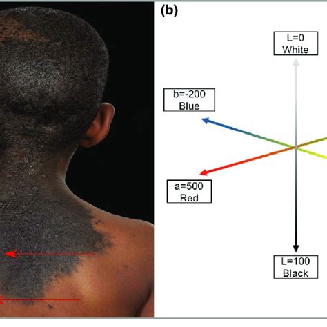 Method Of Measurement Of L A B Colour Space Values From Standardized Download Scientific