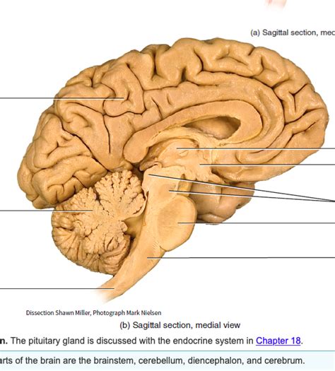 Sagittal Section Medial View Diagram Quizlet