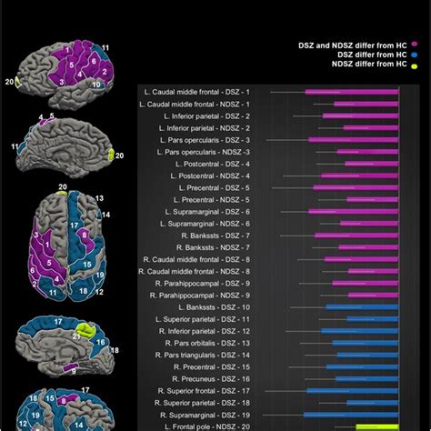 Results Of The Random Effect Meta Analysis On Cortical Thickness