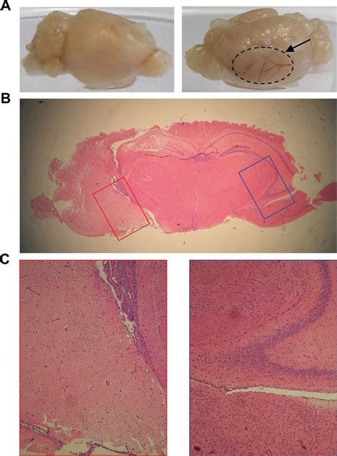 Stroke Induced By Middle Cerebral Artery Occlusion Mcao A Mcao Download Scientific Diagram