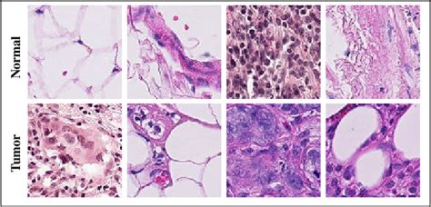Figure 1 From Learning With Less Data Via Weakly Labeled Patch