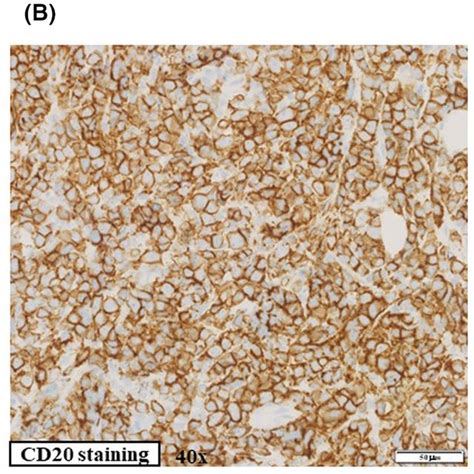 Data Of Asian Working Group For Sarcopenia 2019 Consensus Diagnostic Download Scientific