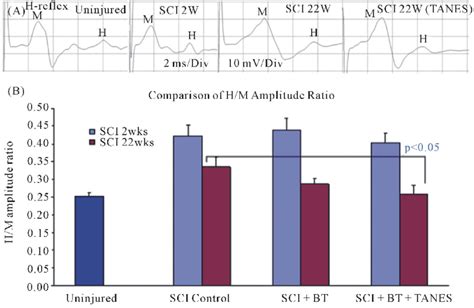 H Reflex Test With Comparison Of H M Amplitude Ratio Representative Download Scientific