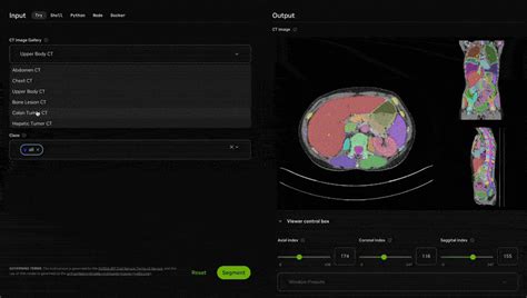 The Ultimate Guide To Medical Image Segmentation With Deep Learning 2d And 3d