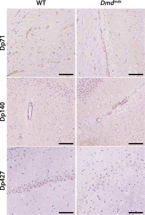 Lack Of Dp427 Dystrophin Isoform In Dmd Mdx Rats Brain And No