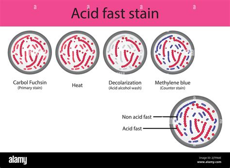 Acid Fast Staining Microbiology Lab Technique Steps Diagram Using